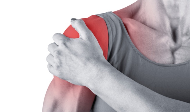 Rotator Cuff Tendinitis Orange County | Shoulder Impingement Syndrome ...